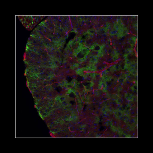 Gallery | IPRM - IPRM